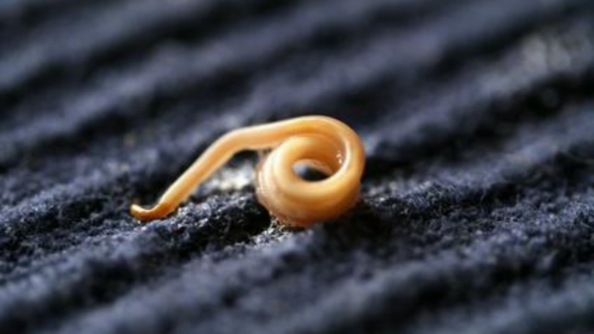 Lima Jenis Cacing Yang Buat Penyakit Dalam Perut